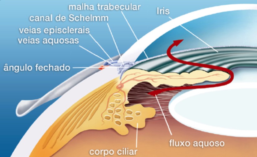 Glaucoma - IOP - Instituto Oftalmológico Paulista
